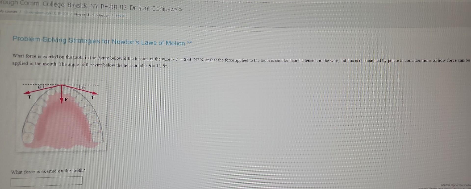Solved applied in the mouth. the angle of the wire below the | Chegg.com