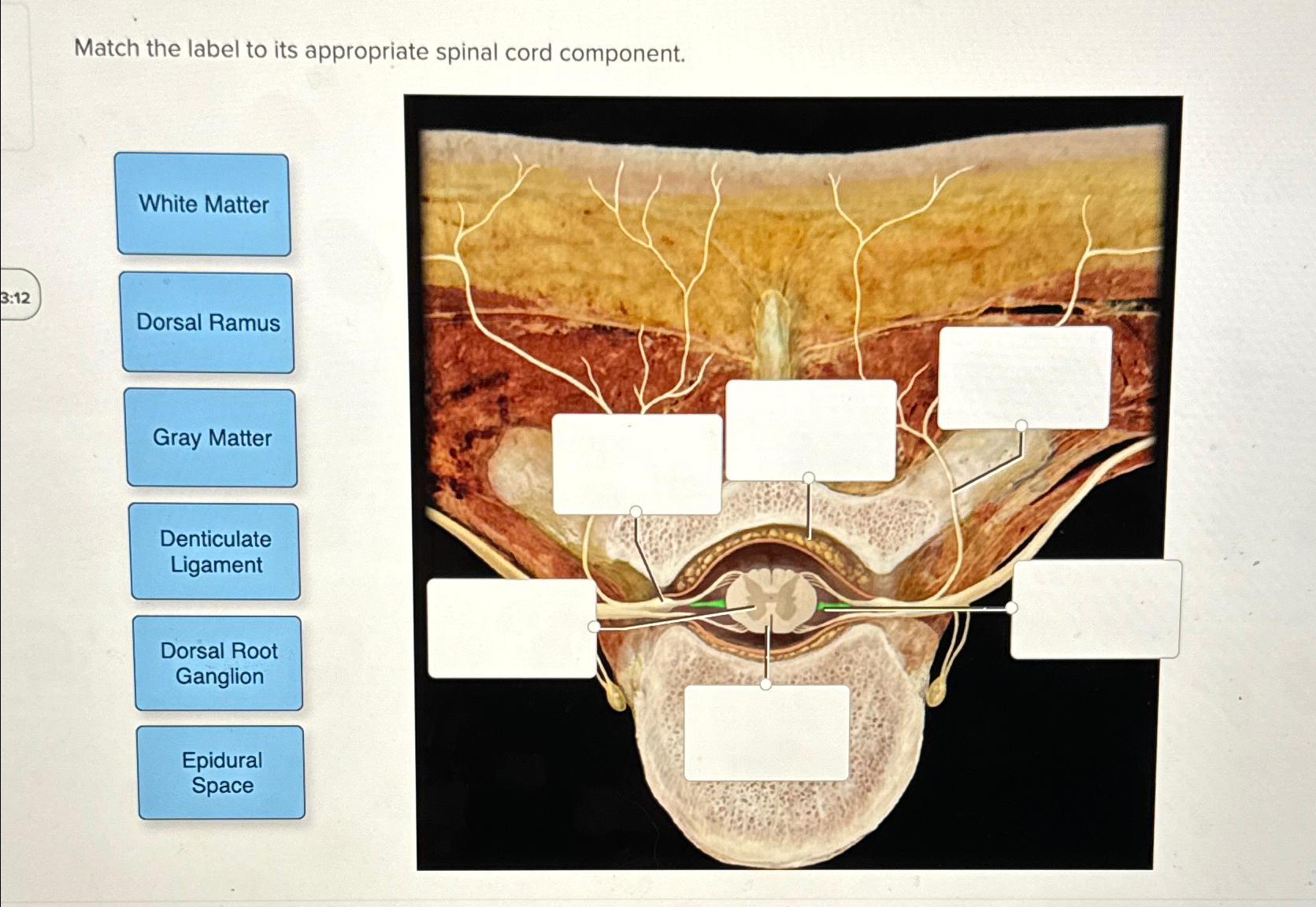 Solved Match the label to its appropriate spinal cord | Chegg.com