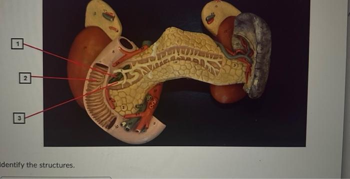 Solved Identify the structures. | Chegg.com