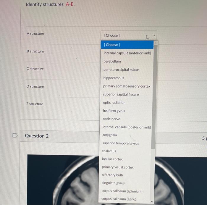 Solved A D (В B C Identify structures A-E. A structure [ | Chegg.com