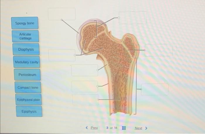 Solved Spongy bone Articular cartilage Diaphysis Medullary | Chegg.com