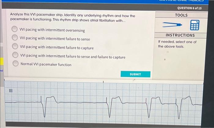 Solved Analyze this VVI pacemaker strip. Identify any | Chegg.com