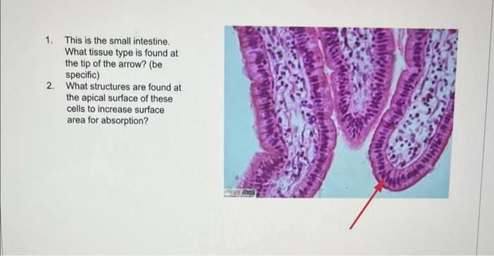 Solved 1. This is the small intestine. What tissue type is | Chegg.com