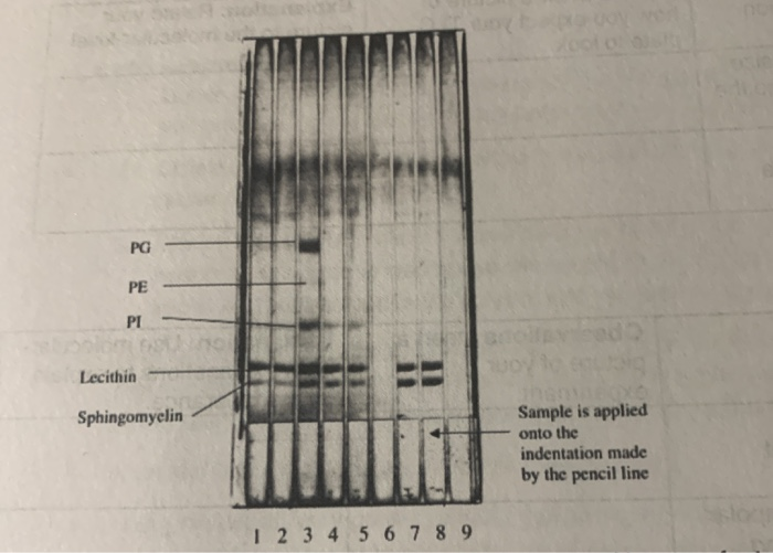 Solved PG PE PI Lecithin Sphingomyelin Sample is applied | Chegg.com