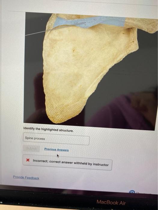 Solved Identify the highlighted structure. Spine process | Chegg.com