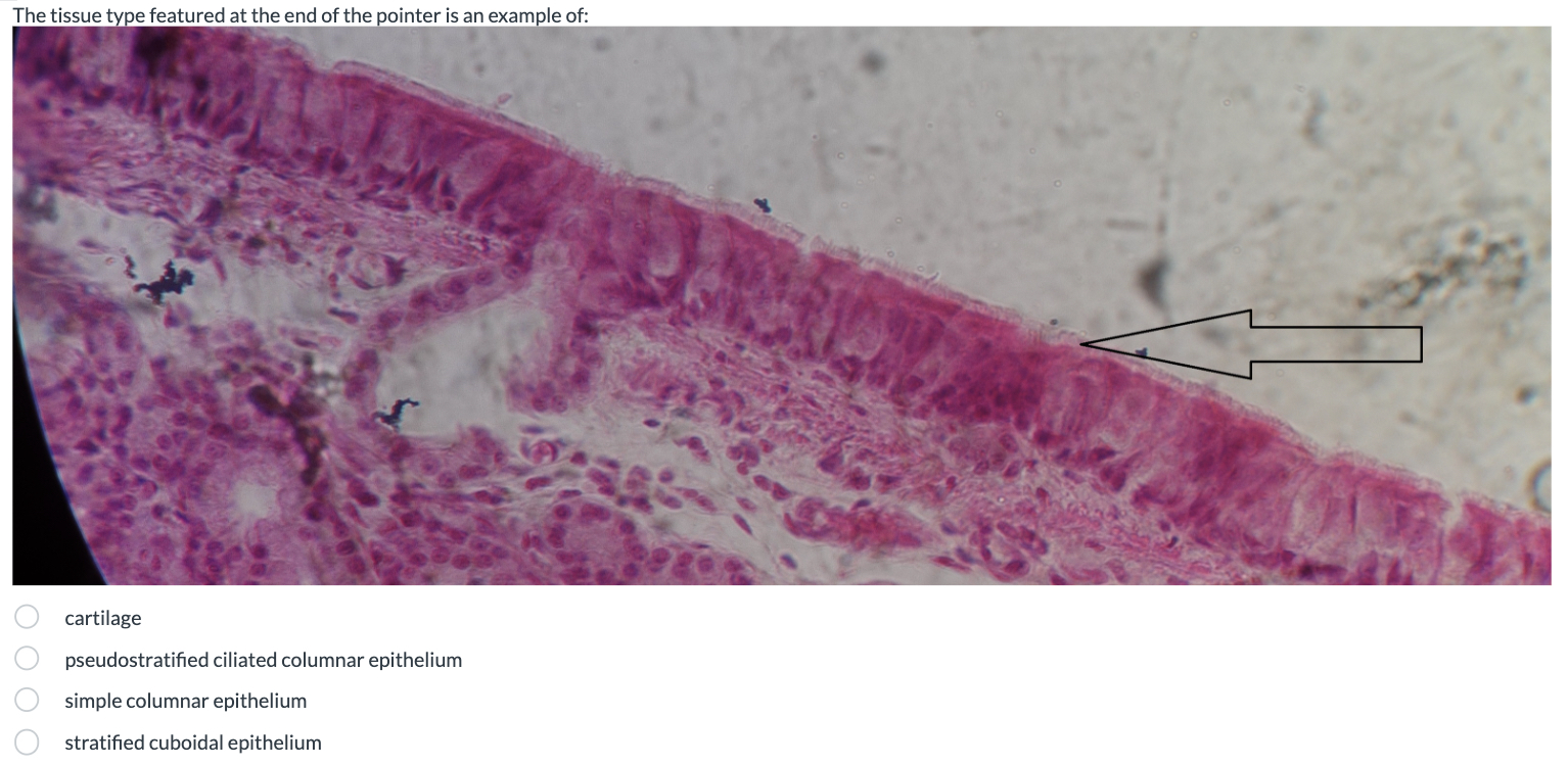 Solved The tissue type featured at the end of the pointer is | Chegg.com