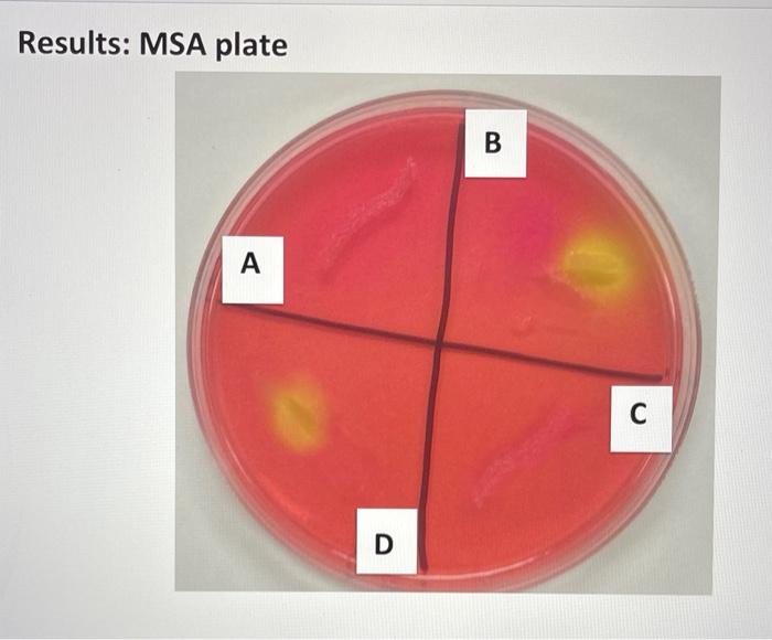Solved Results: Slide AgglutinationResults: MSA | Chegg.com