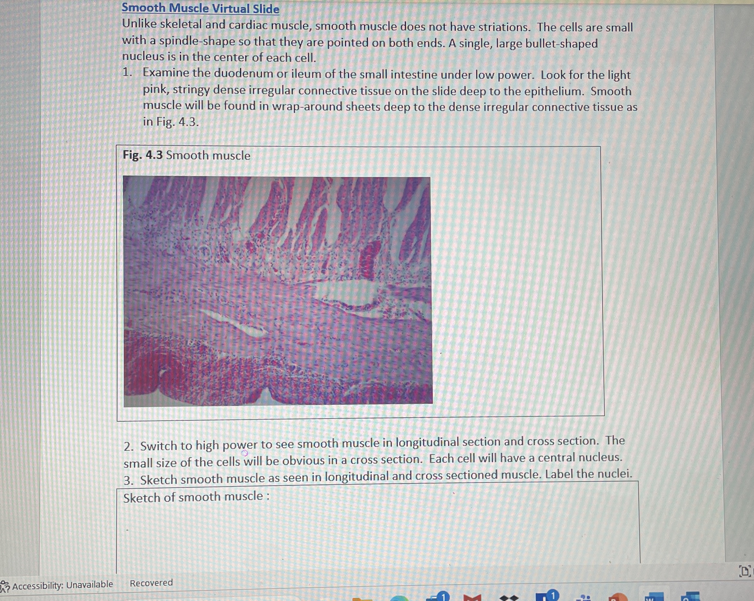 Solved Smooth Muscle Virtual SlideUnlike skeletal and | Chegg.com