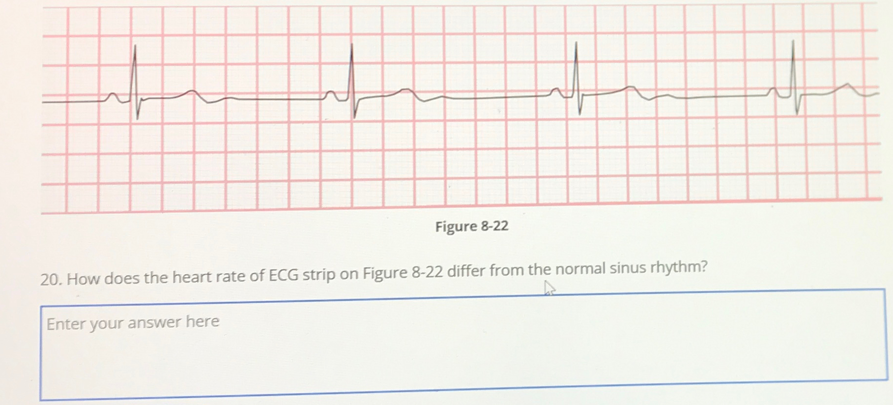 Solved How does the heart rate of ECG strip on Figure 8-22 | Chegg.com