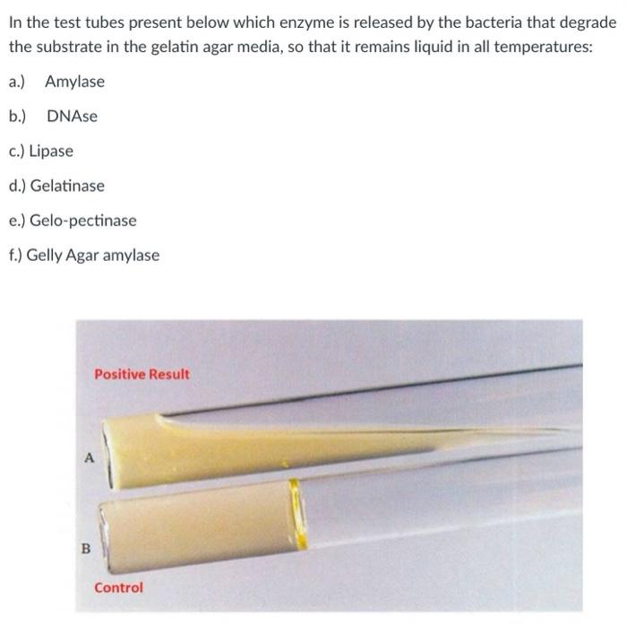 Solved In the test tubes present below which enzyme is | Chegg.com