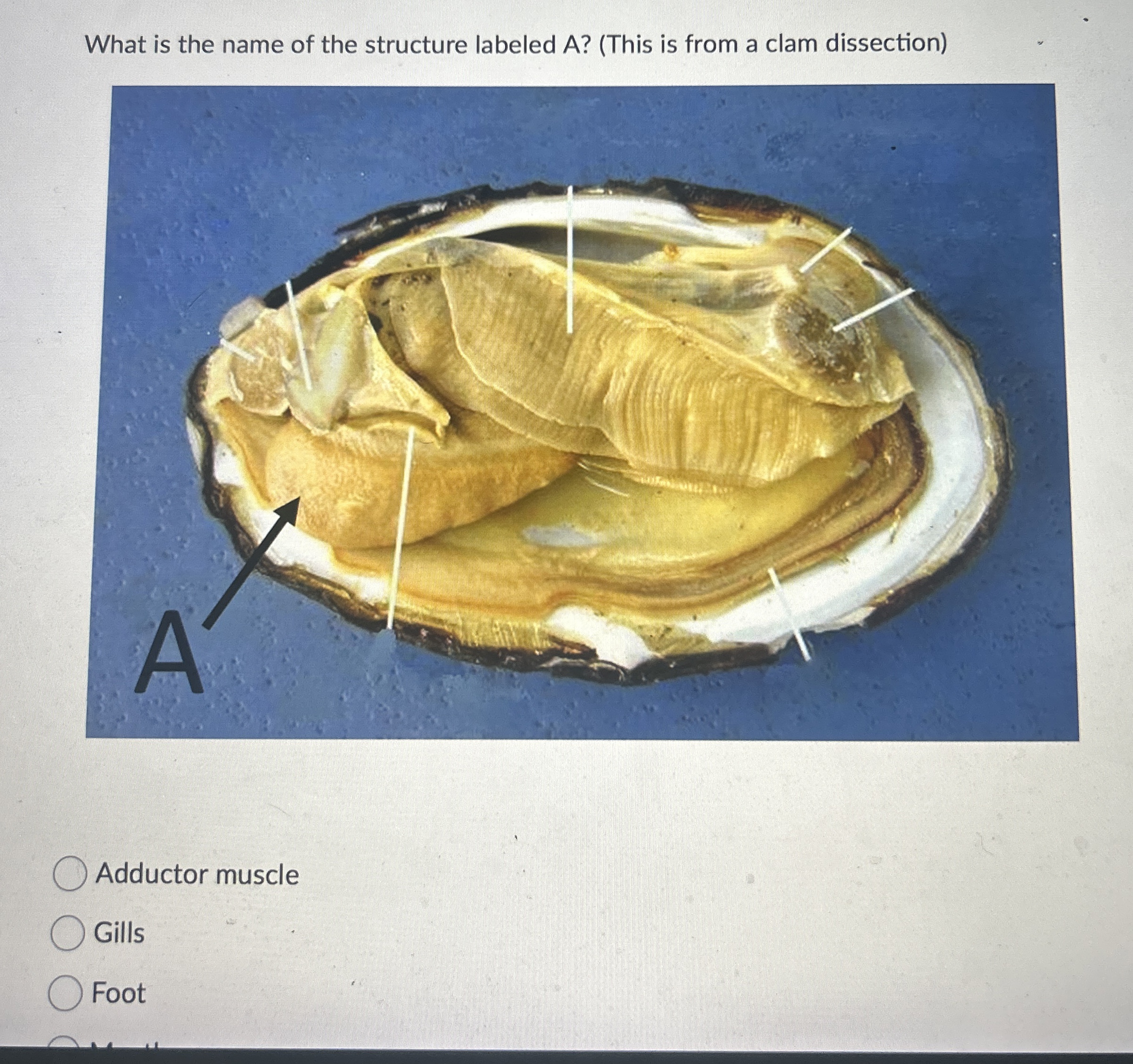 Solved What is the name of the structure labeled A? (This is | Chegg.com