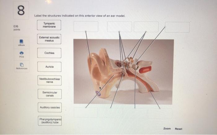 Solved 00 Label the structures indicated on this anterior | Chegg.com