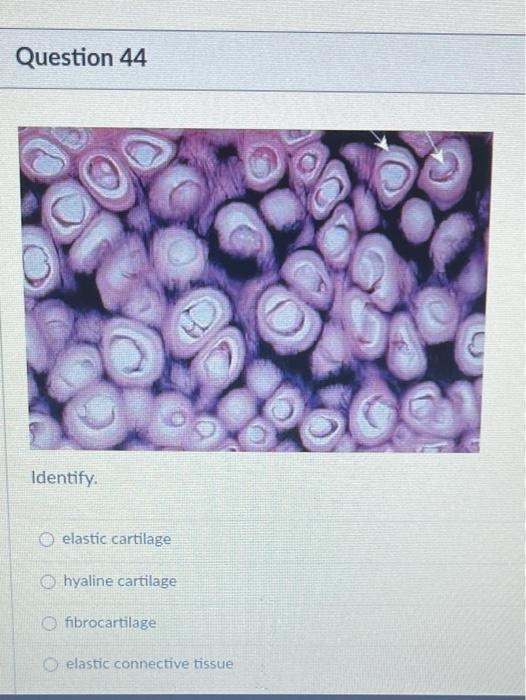 Solved Identify the tissue. O reticular elastic cartilage | Chegg.com