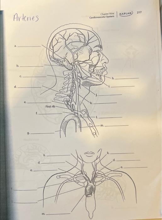 Solved Arteries KAPLAN 215 Chapter Nine Cardiovascular | Chegg.com