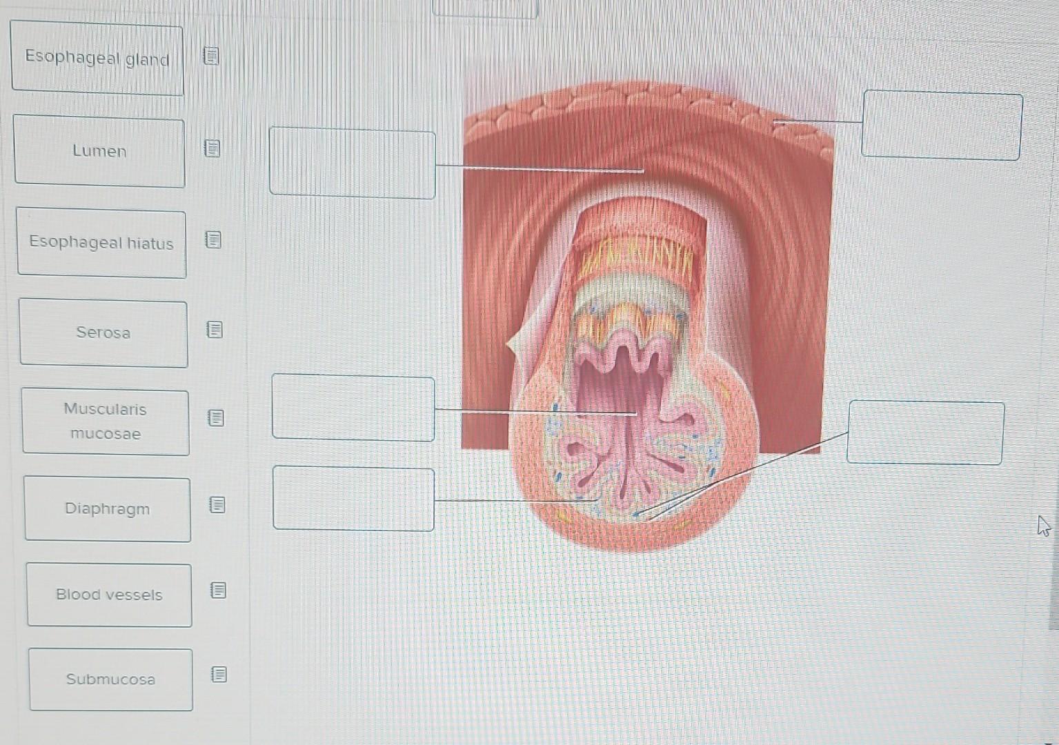 Solved Esophageal gland Lumen Esophageal hiatus 园 Serosa 圆 | Chegg.com