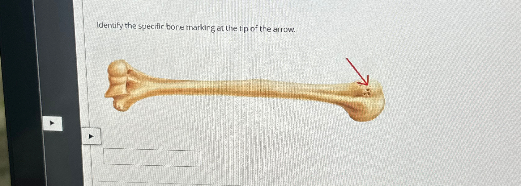 Solved Identify the specific bone marking at the tip of the | Chegg.com