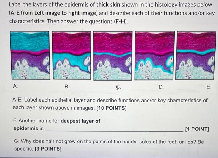 Solved Label the layers of the epidermis of thick skin shown | Chegg.com