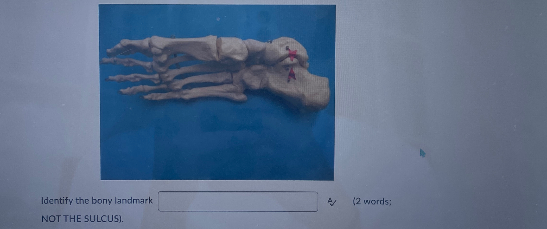 Solved Identify the bony landmarkA(2 ﻿words;NOT THE SULCUS). | Chegg.com