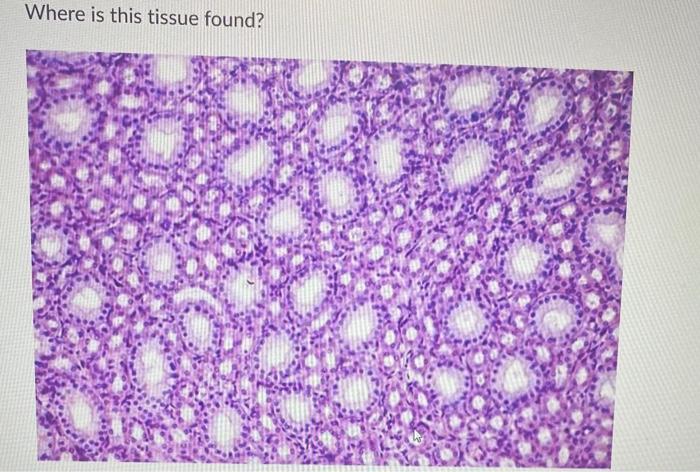Solved What is the specific tissue type of this specimen? | Chegg.com