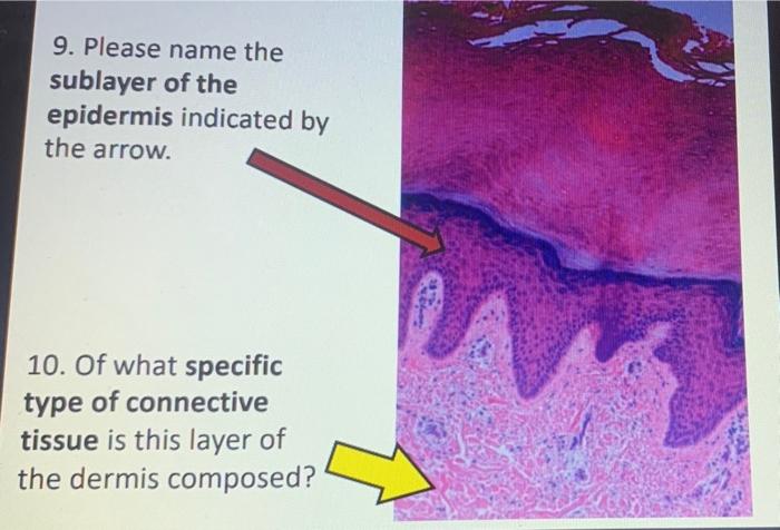 Solved 9. Please name the sublayer of the epidermis | Chegg.com