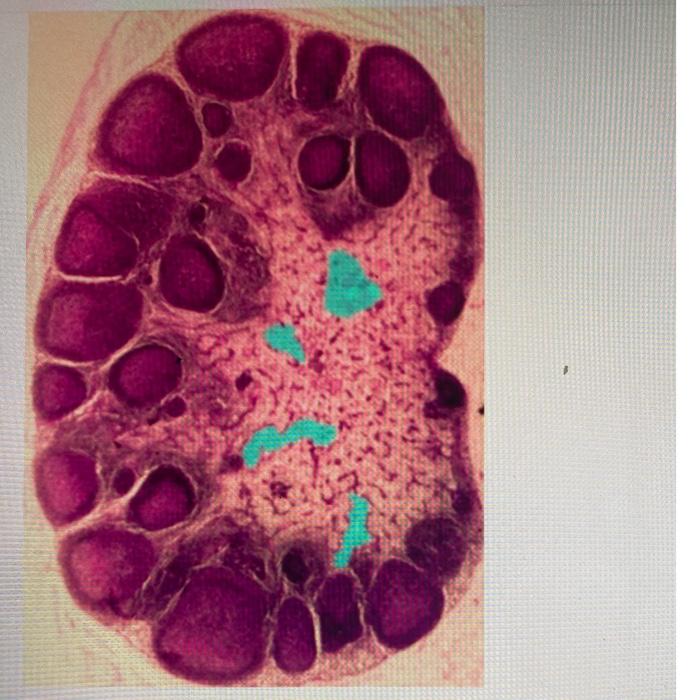 Solved O trabecula of lymph node cortex of lymph node O | Chegg.com