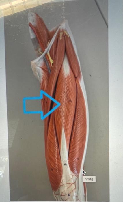 Solved please identify the name & function of the muscle | Chegg.com