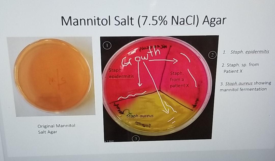 Solved Mannitol Salt (7.5% NaCl) Agar 1. Staph. epidermitis | Chegg.com