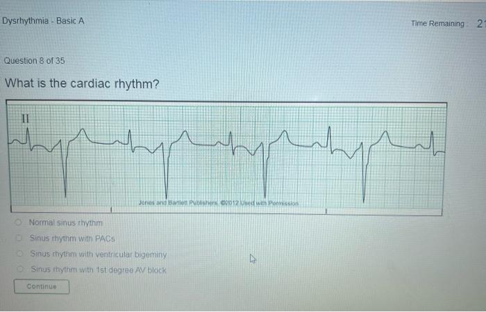 [Solved]: Dysrhythmia - Basic A Time Remaining - ( 2 i )