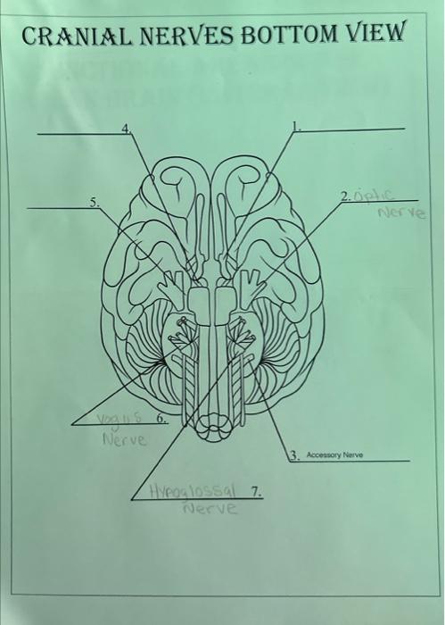 Solved CRANIAL NERVES BOTTOM VIEW **There are more terms | Chegg.com