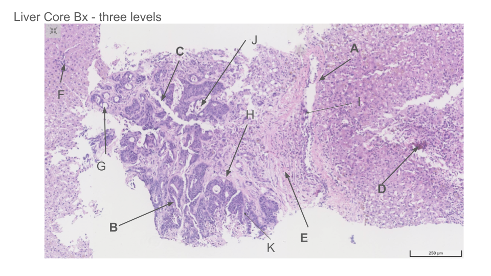 Solved Can you please label this image and describe the | Chegg.com