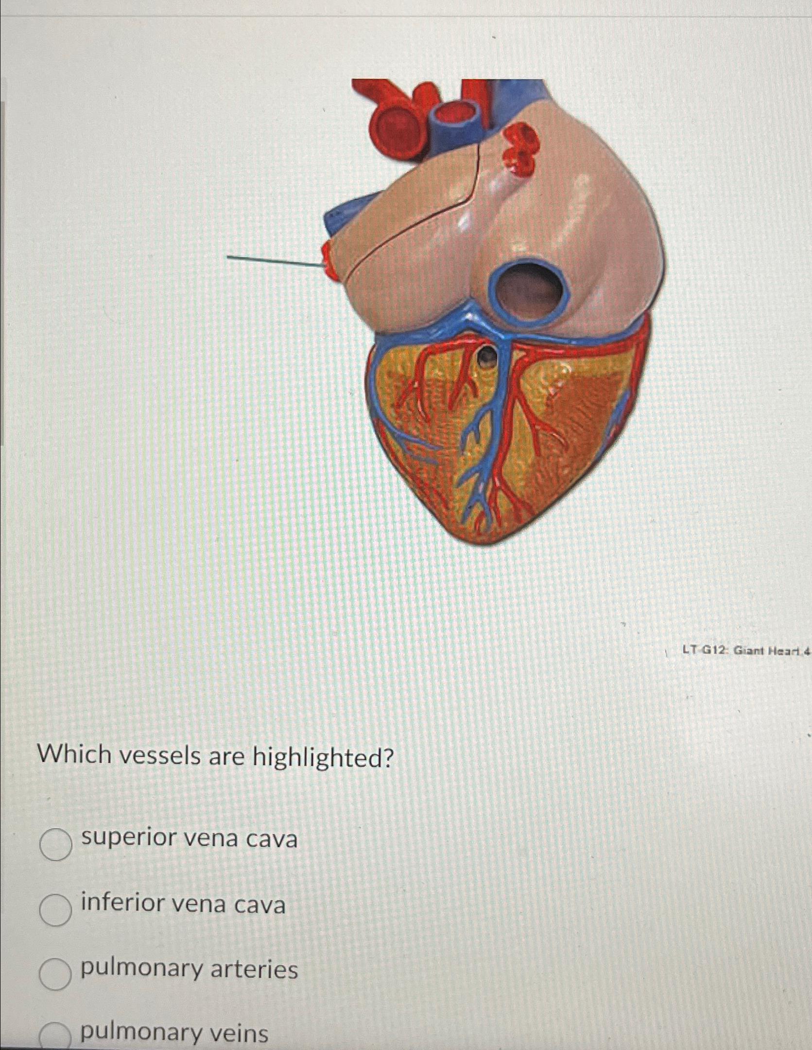 Solved Which vessels are highlighted?superior vena | Chegg.com