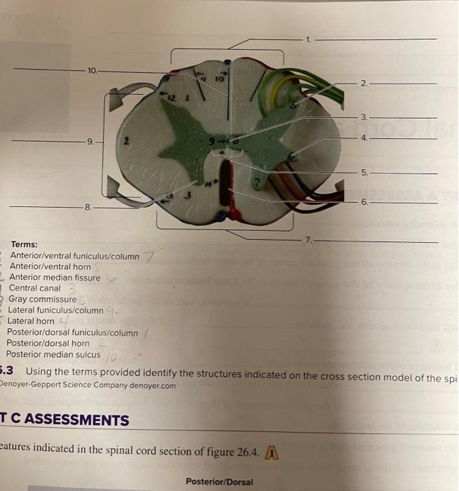 Solved Anterior/ventral funiculus/column Anterior/ventral | Chegg.com