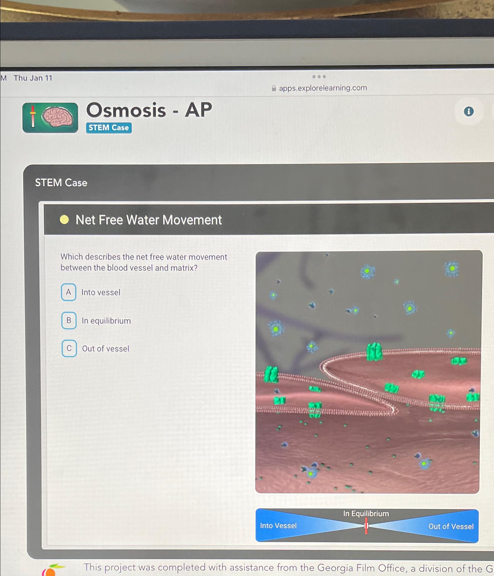 Solved Osmosis - ﻿AP(1)STEM CaseSTEM CaseNet Free Water | Chegg.com