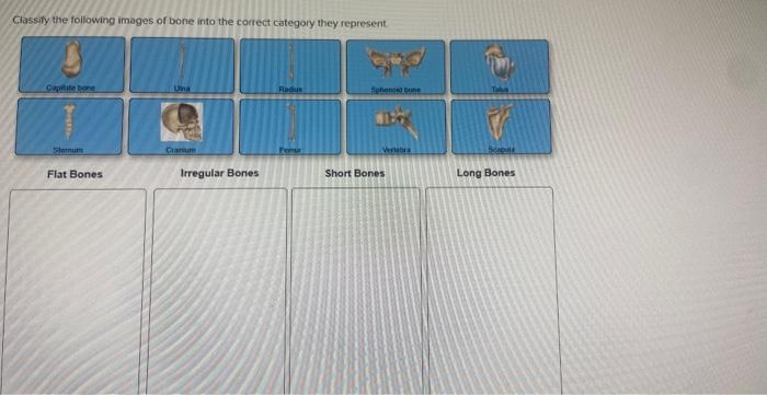 Classify the following images of bone into the | Chegg.com