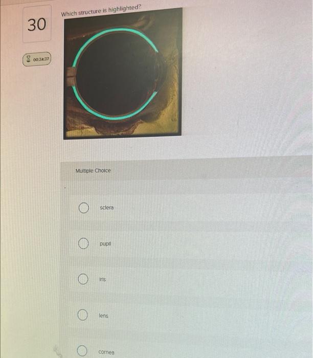 Solved Which structure is highlighted? 34 Multiple Choice | Chegg.com