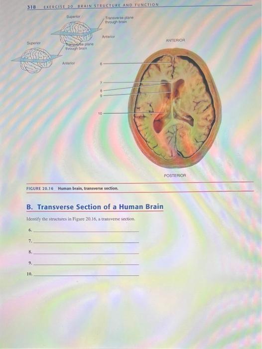 Solved 318 EXERCISE 20 BRAIN STRUCTURE AND FUNCTION Guperior | Chegg.com