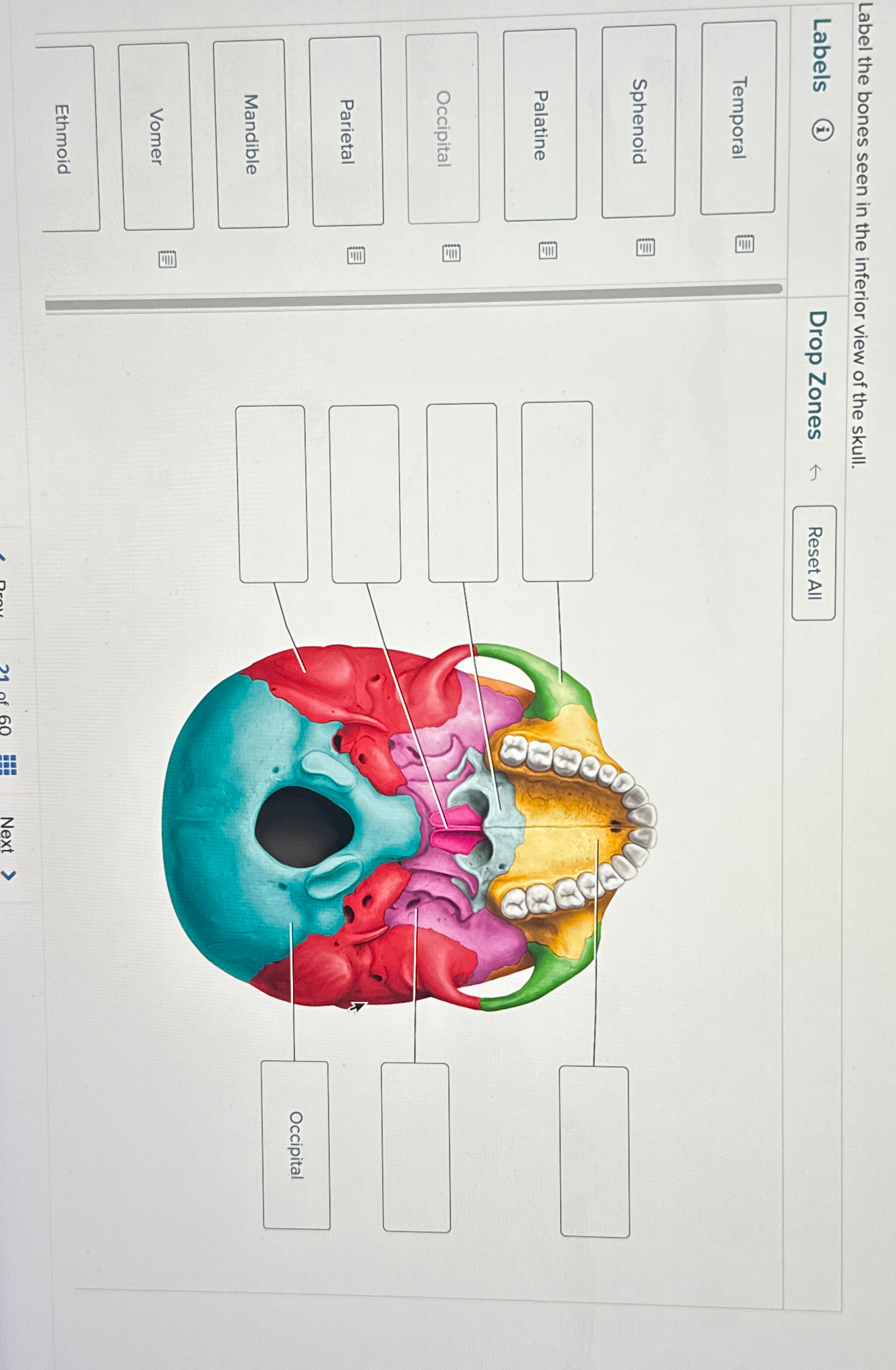 Solved Label the bones seen in the inferior view of the | Chegg.com