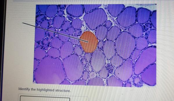 Solved Identify the highlighted structure. | Chegg.com