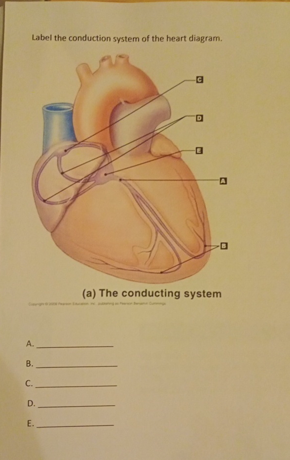 Solved Label the conduction system of the heart diagram.(a) | Chegg.com