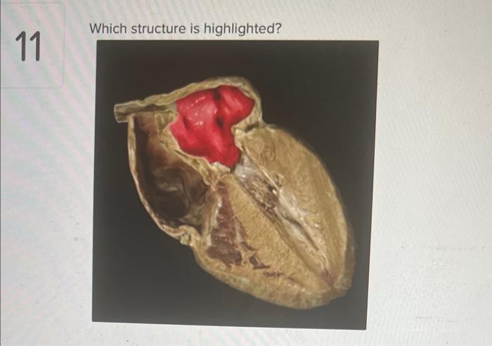 Solved Which structure is highlighted? Multiple Choice | Chegg.com