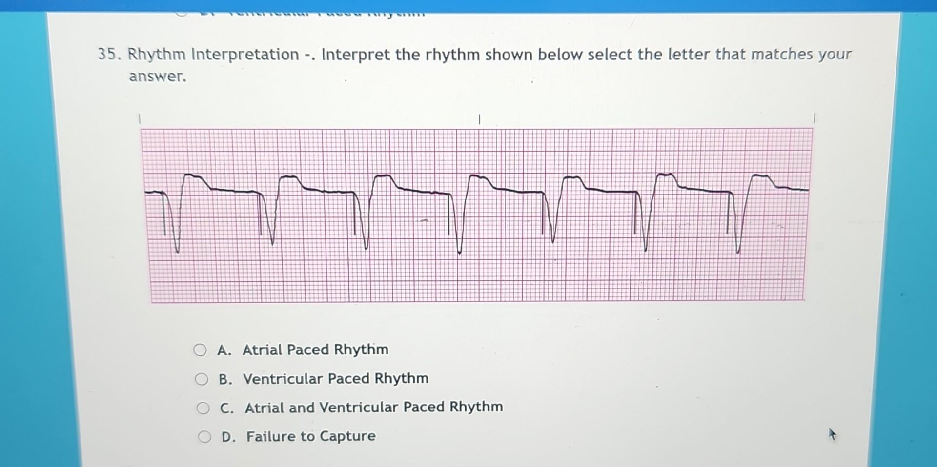Solved 35. Rhythm Interpretation -. Interpret the rhythm | Chegg.com
