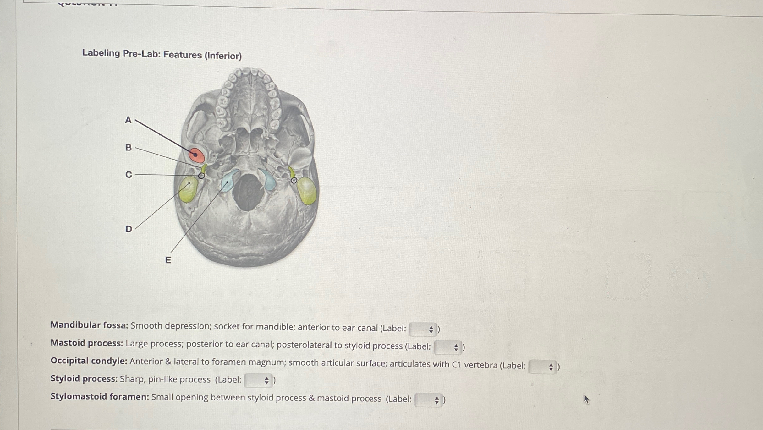 Solved Labeling Pre-Lab: Features (Inferior)Mandibular | Chegg.com