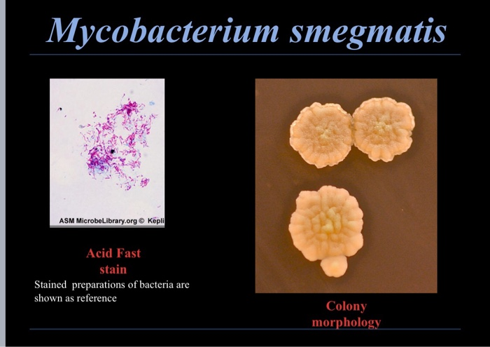 Solved Bacterial Morphology and Colony Morphology Report | Chegg.com