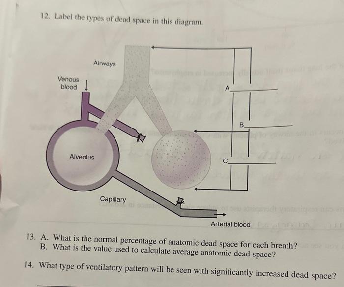 Solved 12. Label the types of dead space in this diagram. | Chegg.com