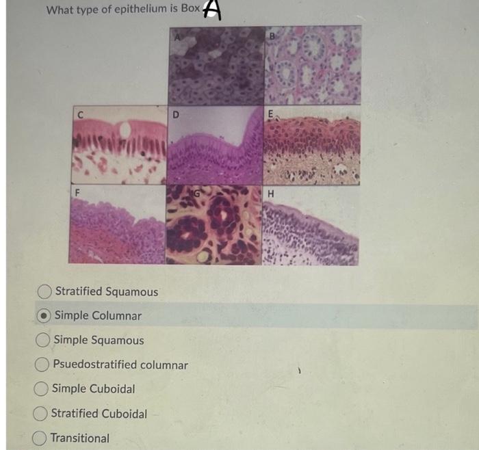 Solved What type of epithelium is Box Stratified Squamous | Chegg.com