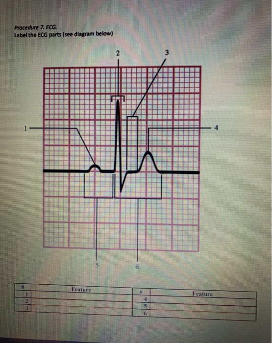 Solved Procedure 7. ECG. Label the ECG parts (see diagram | Chegg.com
