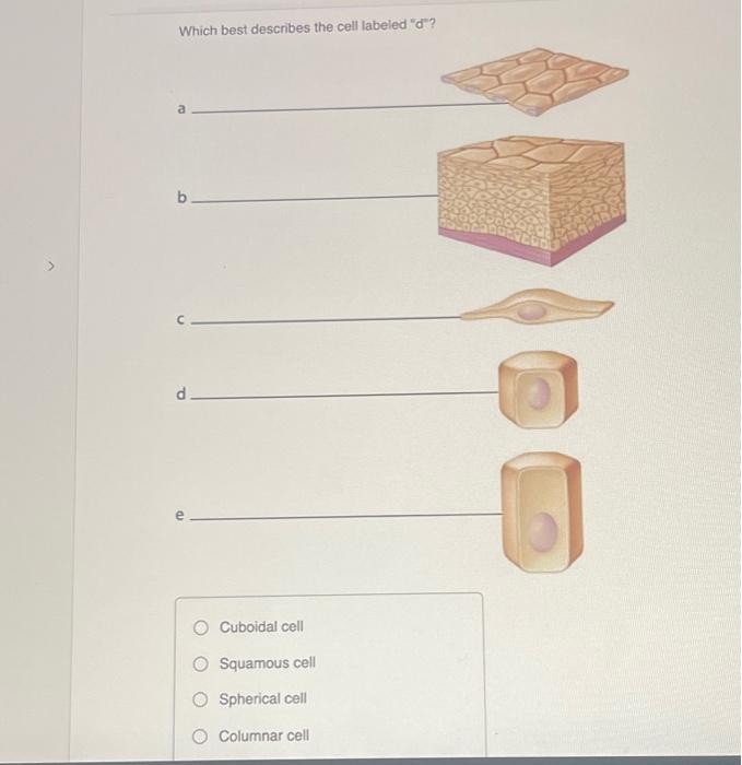 Solved Which best describes the cell labeled "d"? a b d e | Chegg.com