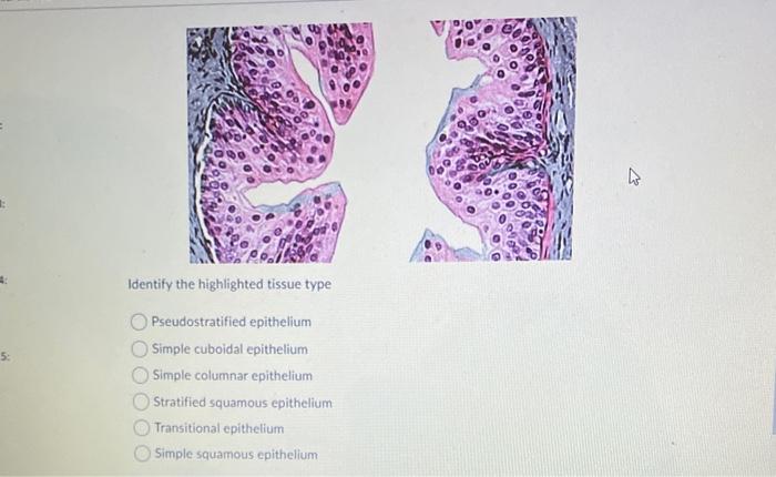 Solved Identify the highlighted tissue type 5: | Chegg.com
