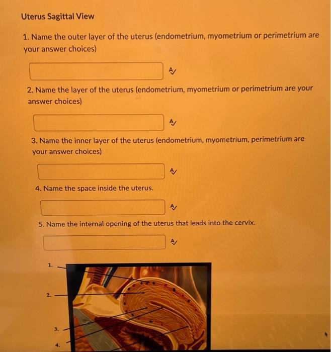 Solved Uterus Sagittal View 1. Name the outer layer of the | Chegg.com