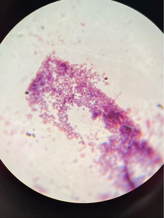 Solved Identify this unknown bacteria on this gram stain | Chegg.com